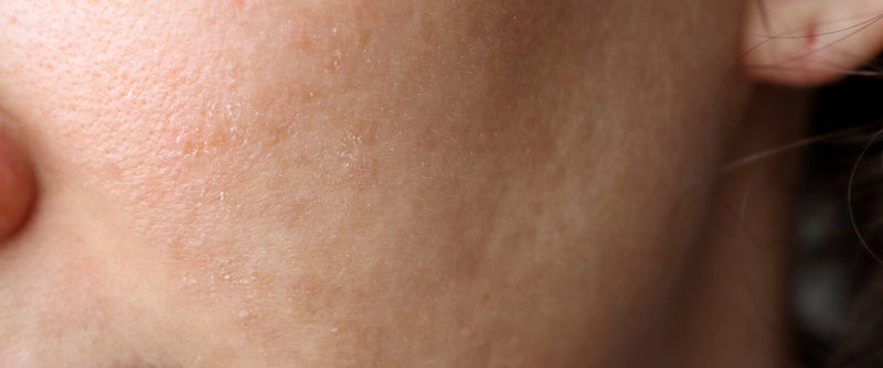 The Best Way to Take Care of Textured Skin | Epicuren Discovery
